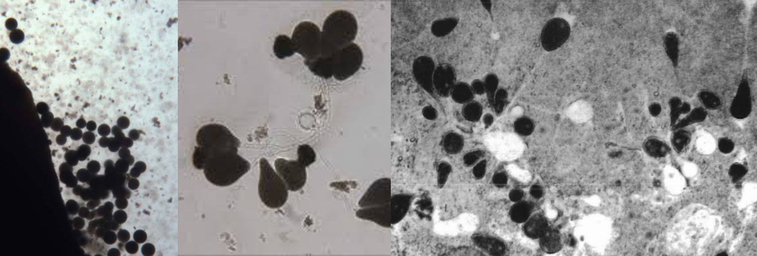 Ichthyophonus: animal meets fungi – Catrin Wendt